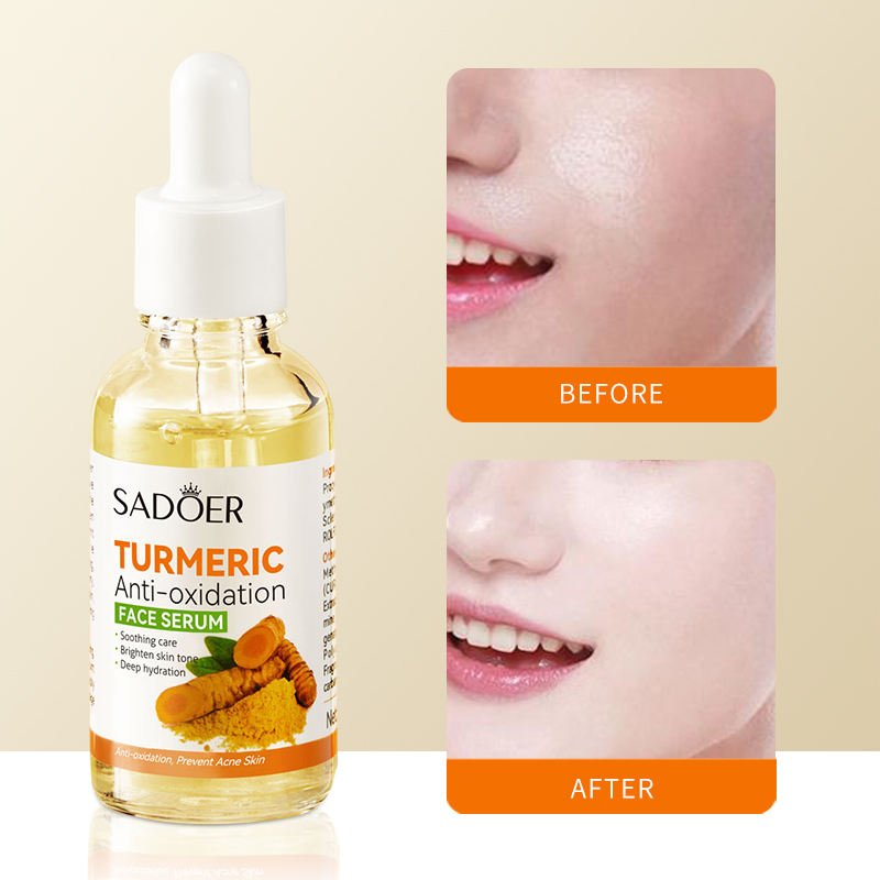 SADOER Wholesale anti aging vitamin c skin care serum Anti acne ...