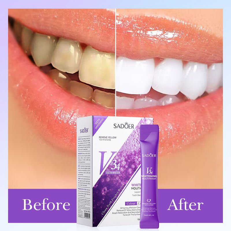 OEM Private Label V34 10ml Portable Sachet Pocket Mouth Wash Mouth ...