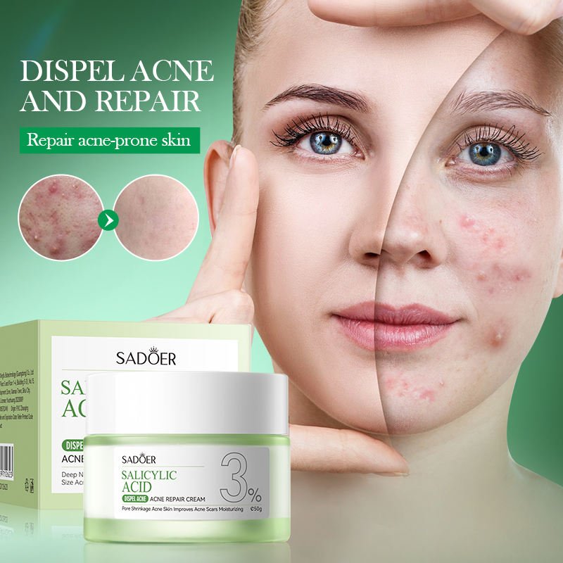 SADOER Best Selling Quick Acne Removing Moisturizing Treatment Scar ...